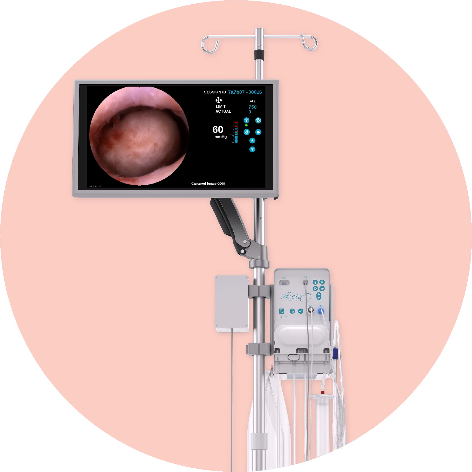 Hysteroscopy Tissue Removal Suite | Aveta® System