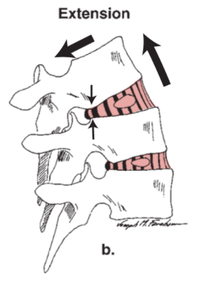 El Músculo del Mes | Multífidos: función muscular — NMIT