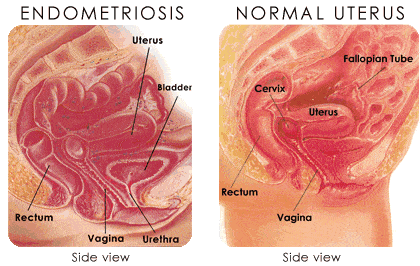 Endometrium Side View