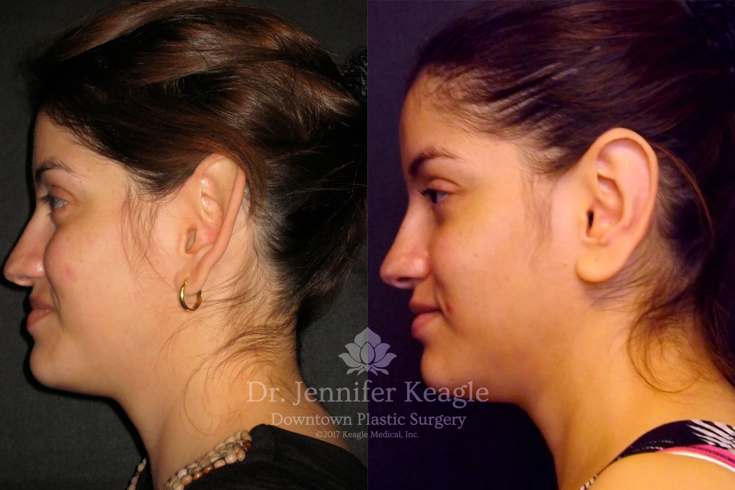 Dr. Jennifer Keagle | Female Plastic Surgeon Downtown Los Angeles ...