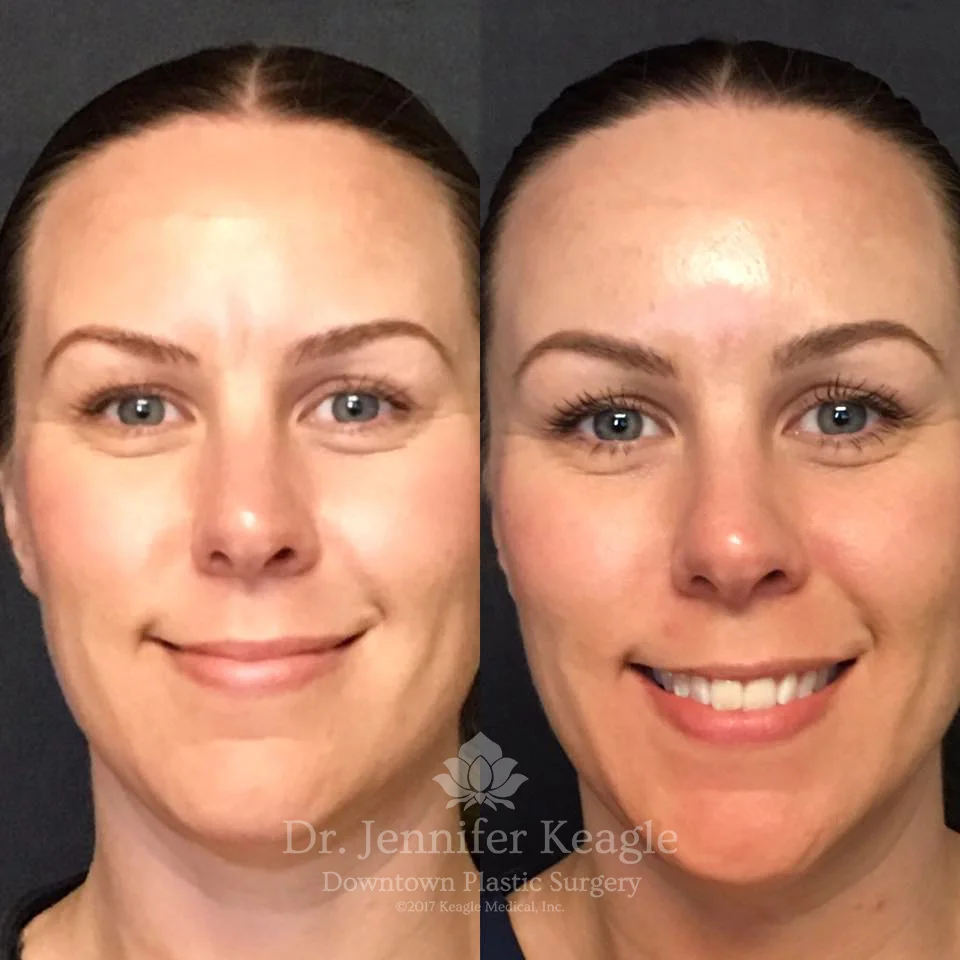 Dr. Jennifer Keagle | Female Plastic Surgeon Downtown Los Angeles ...