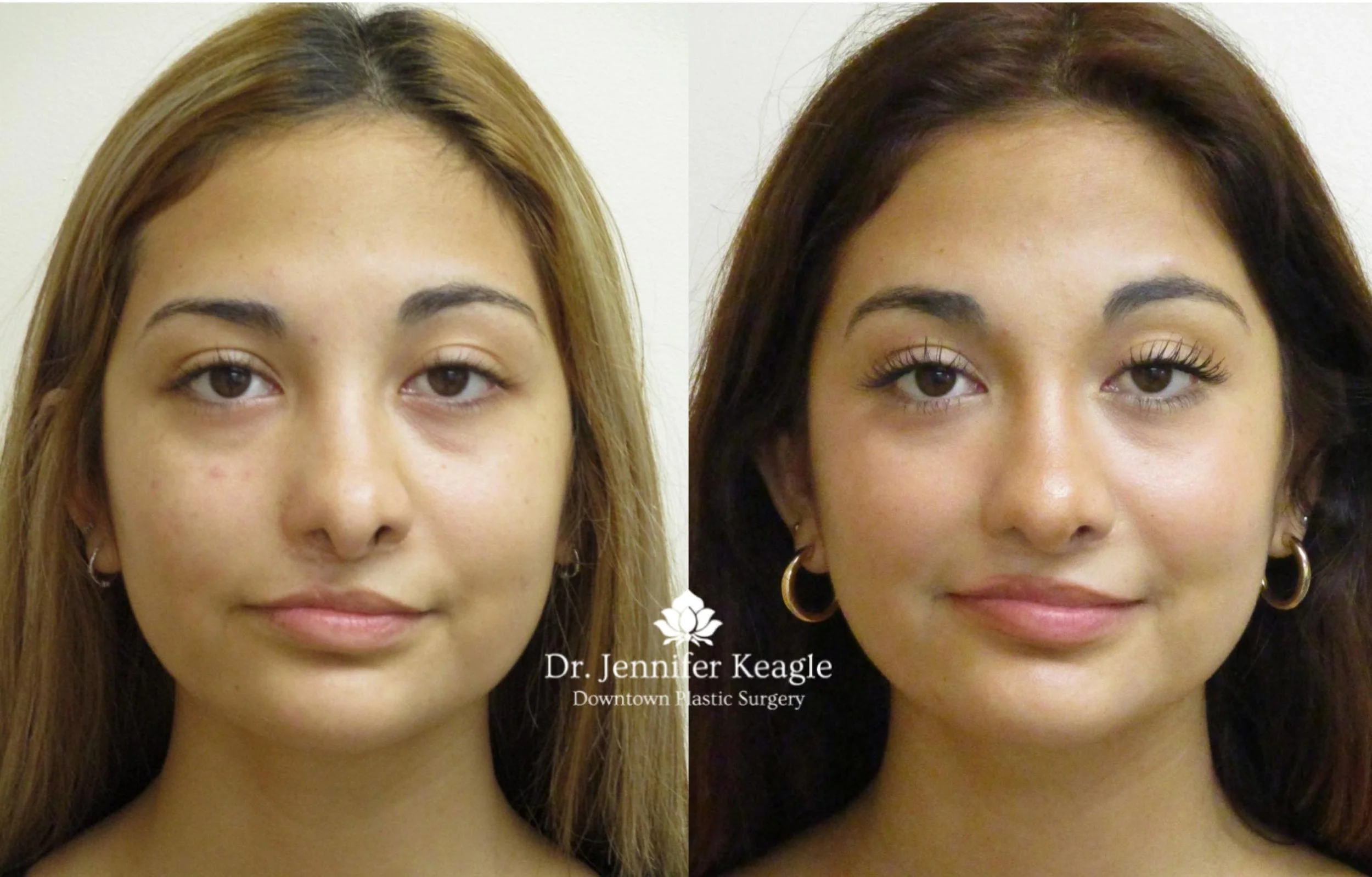 Dr. Jennifer Keagle | Female Plastic Surgeon Downtown Los Angeles ...