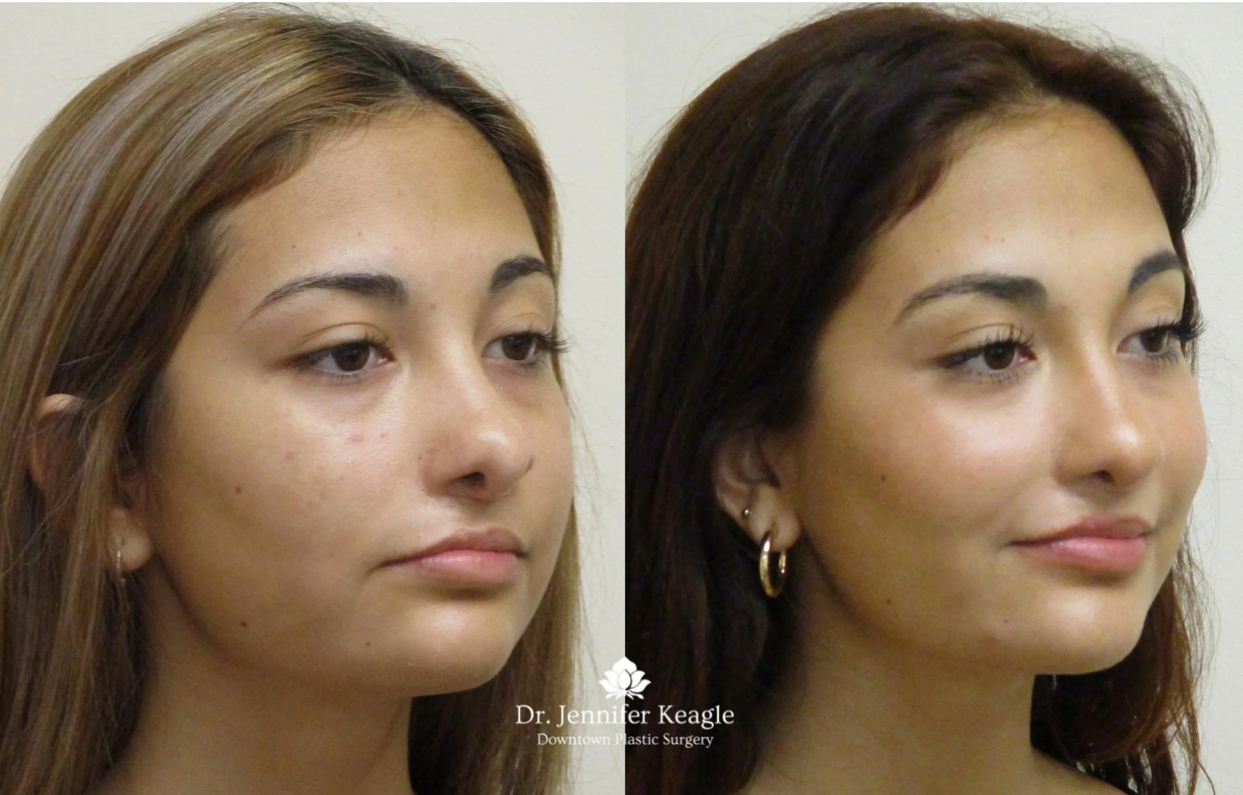 Dr. Jennifer Keagle | Female Plastic Surgeon Downtown Los Angeles ...