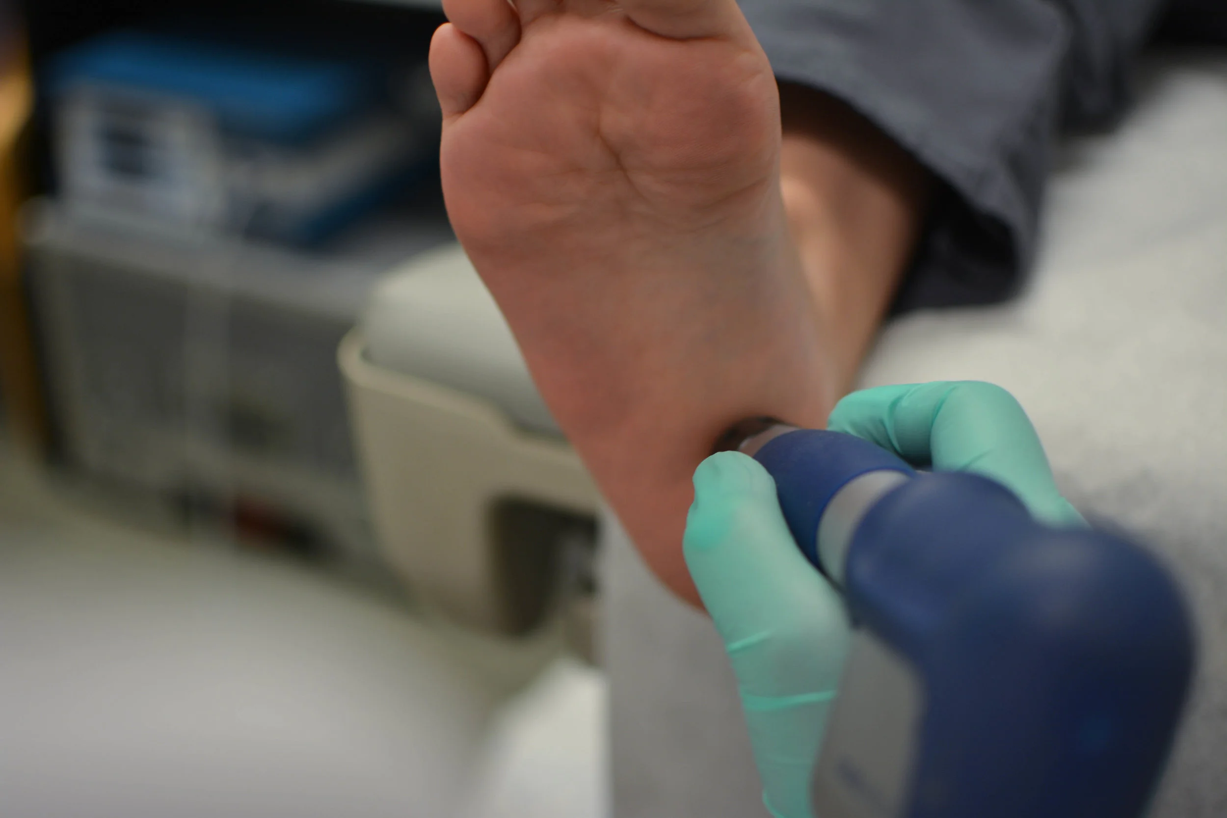 Treatments — Axis Foot & Ankle Clinic | Dr. A Irvine – A Calgary Podiatrist