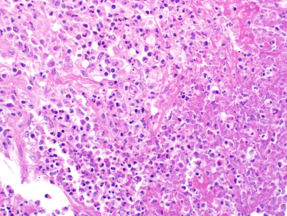 Neutrophils Histology