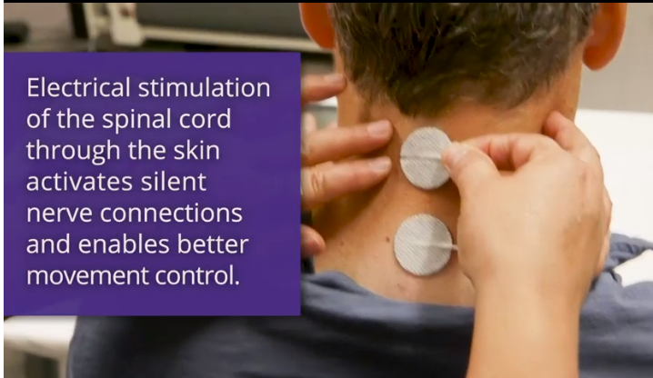 New electrical stimulation treatment may allow those with chronic ...