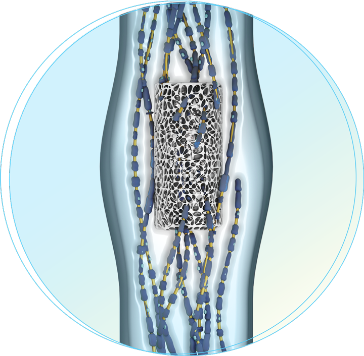 U2FP's CureCast podcast interview: clinical trials of Neuro-Spinal ...