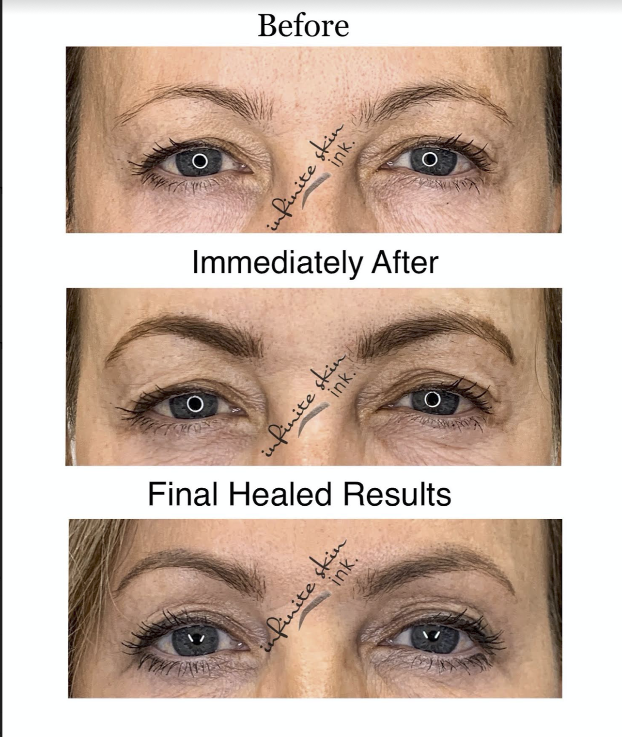 Permanent Makeup Before And After Care Mugeek Vidalondon