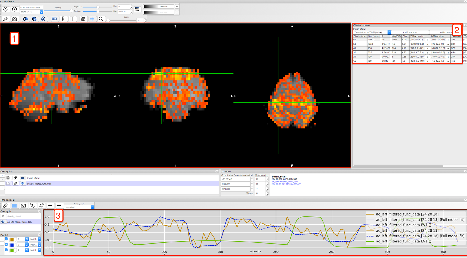 Introduction to FSLeyes: Playlist and Tutorials — Andy's Brain Blog