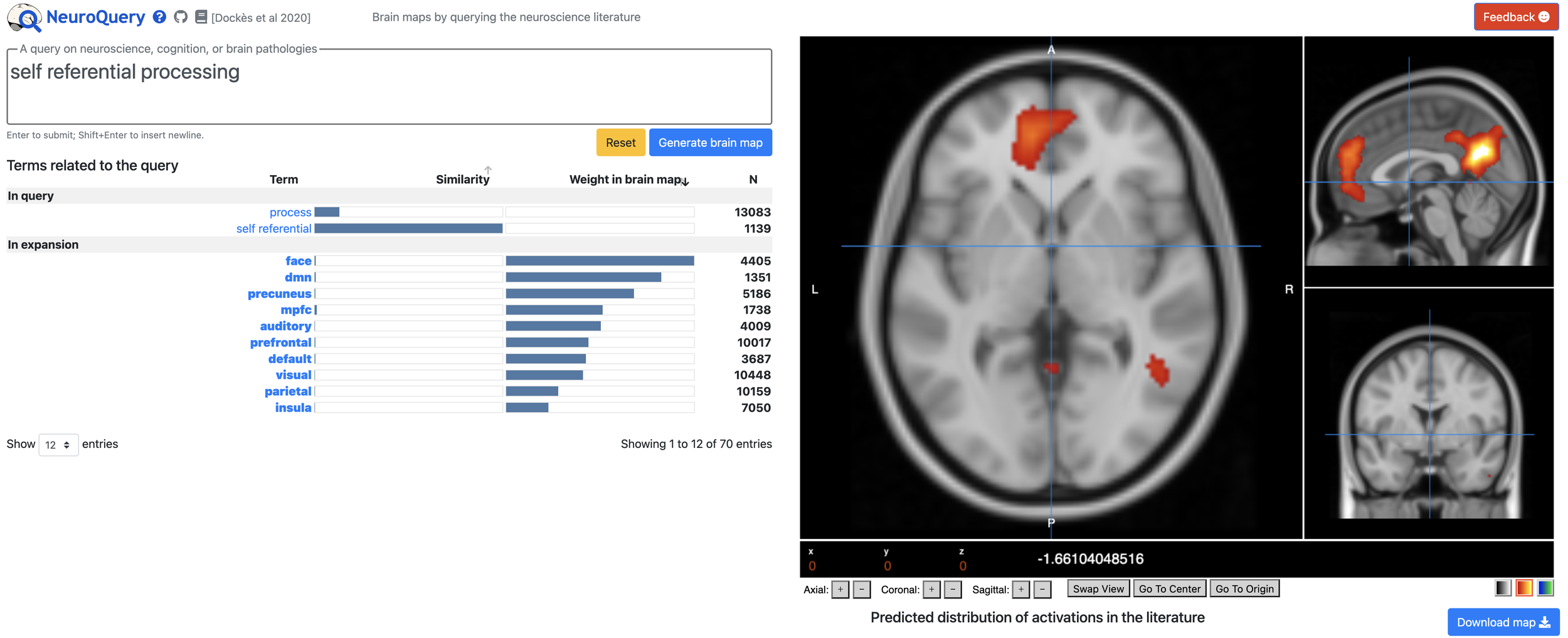 Andy's Brain Blog