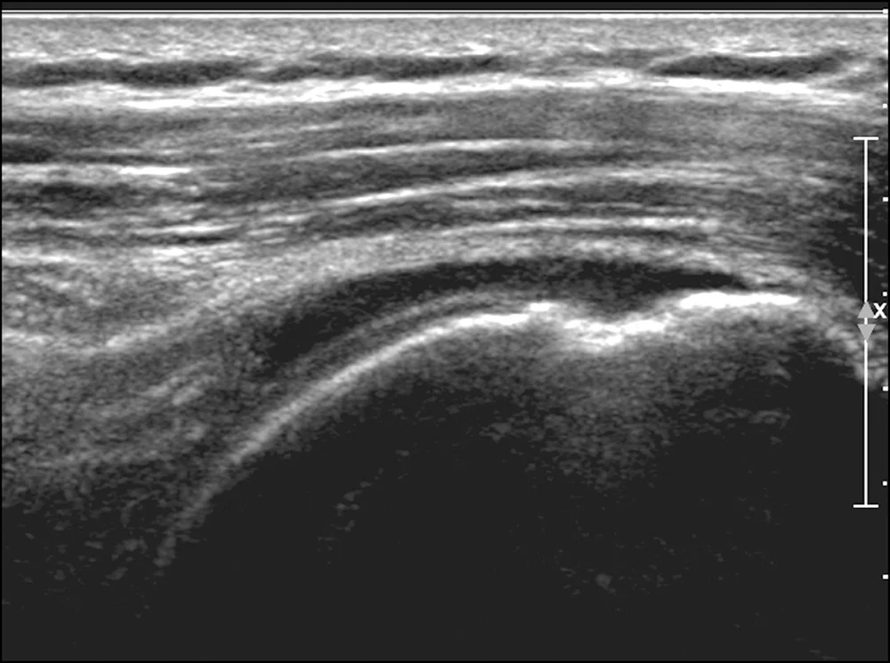 Home — Musculoskeletal Ultrasound