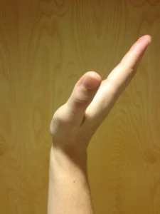 Anatomy of the Wrist — ACRO: Physical Therapy, Massage Therapy & Aerial ...