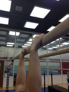 TFCC Injury: the "meniscus tear" of the wrist — ACRO: Physical Therapy ...