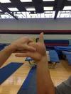TFCC Injury: the "meniscus tear" of the wrist — ACRO: Physical Therapy ...
