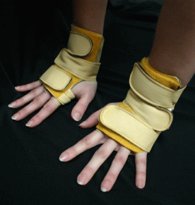 TFCC Injury: the "meniscus tear" of the wrist — ACRO: Physical Therapy ...