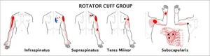 Arm & hand pain: When it could actually be your shoulder... — ACRO ...