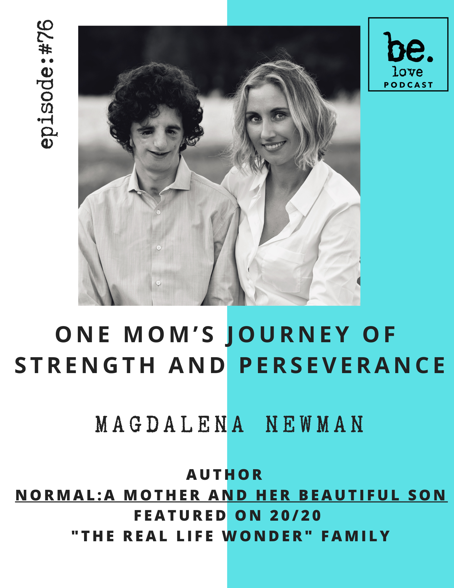 Treacher Collins Syndrome Nathaniel Newman