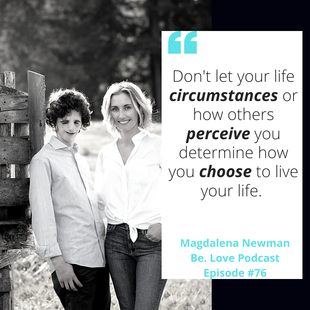 Treacher Collins Syndrome Nathaniel Newman