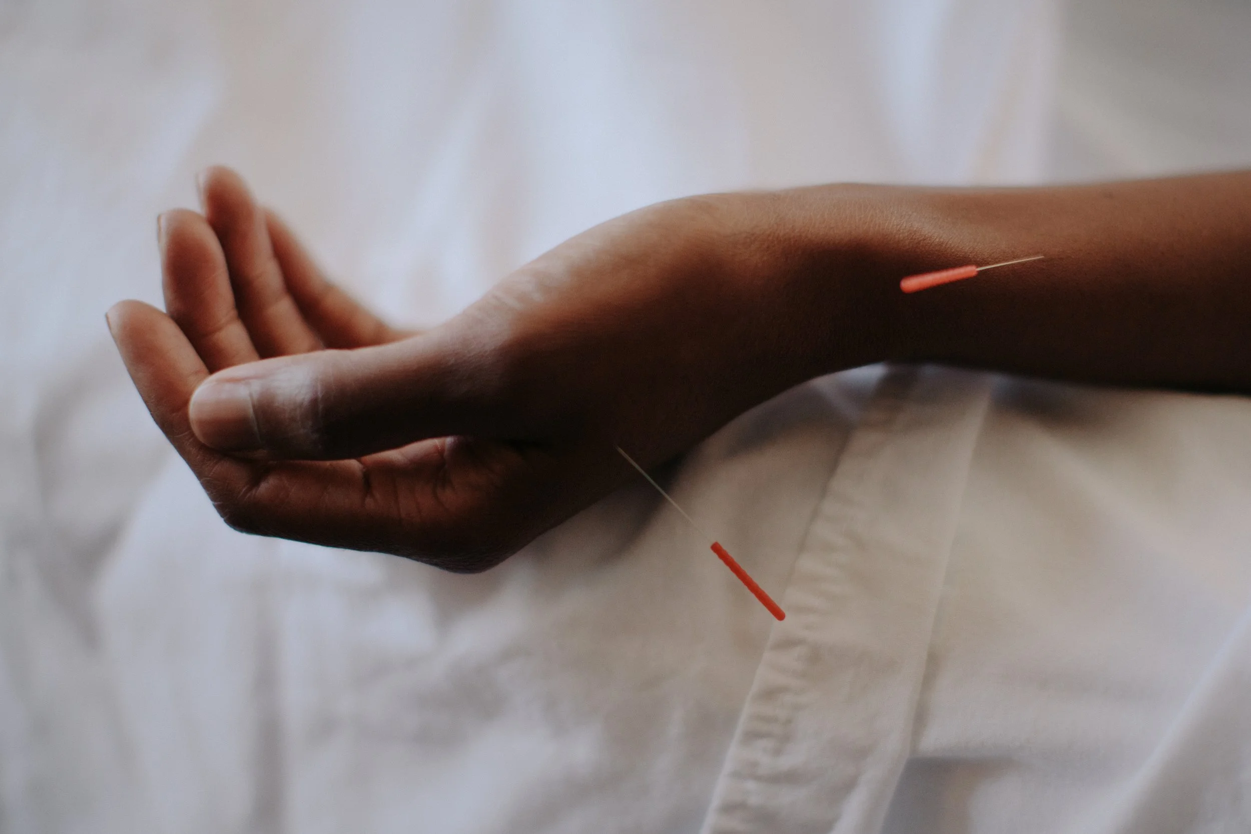 Acupuncture Explained: Form and Function — The Acupuncture Spot