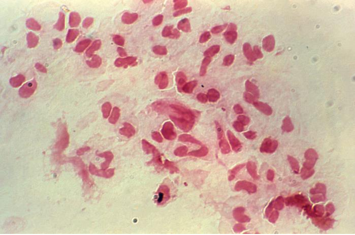 Chlamydia Trachomatis Gram Stain