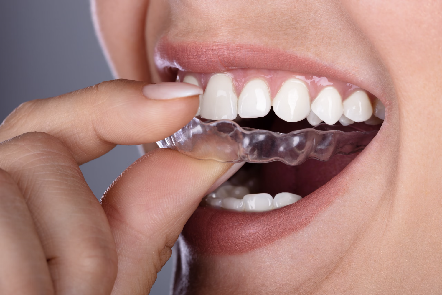 Jonathan Zoutendam, DDS - TraverseDental