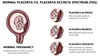 National Accreta Foundation — What is Placenta Accreta Spectrum?