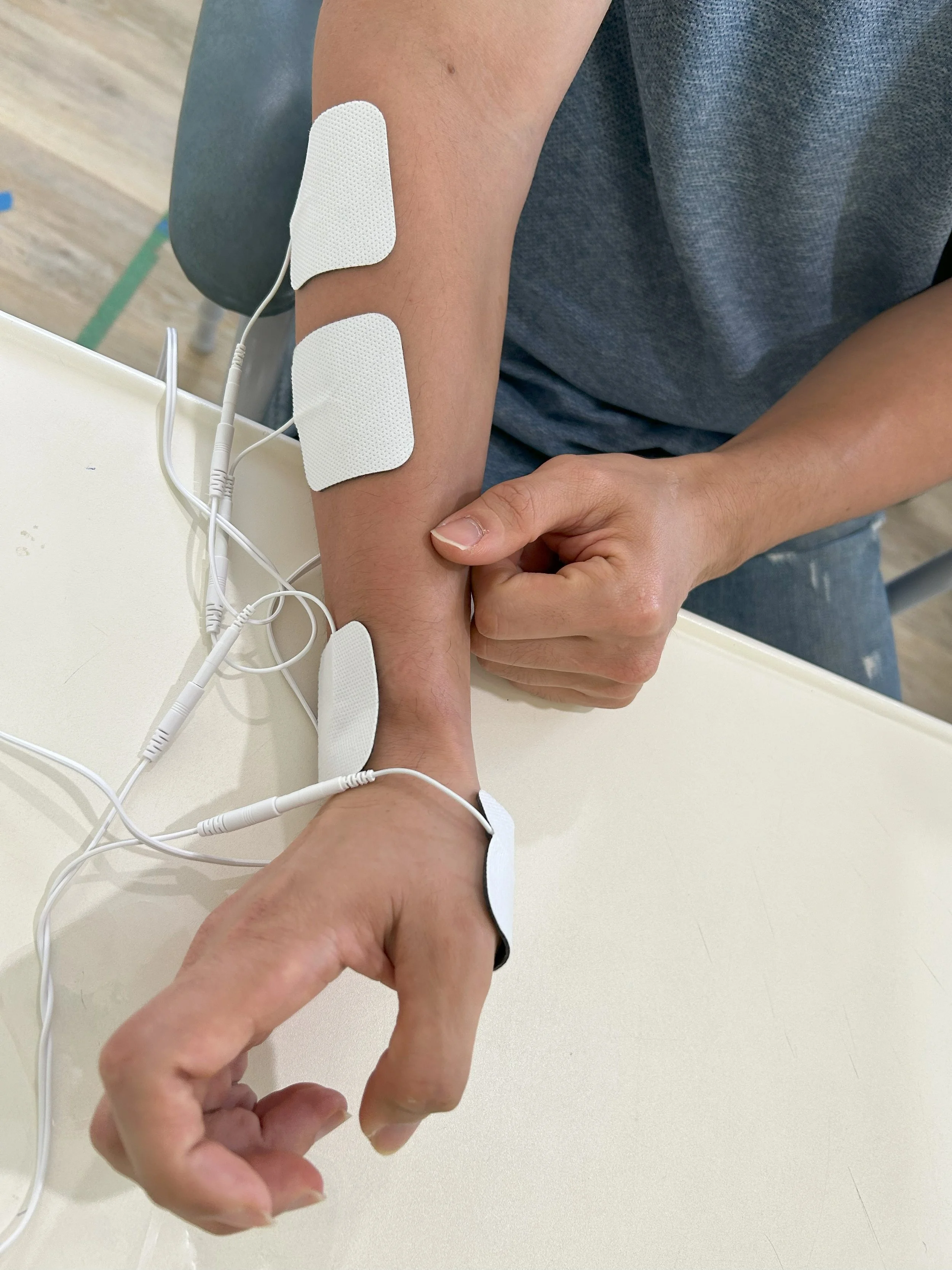 Hypertonicity and Spasticity — Neuro Junction