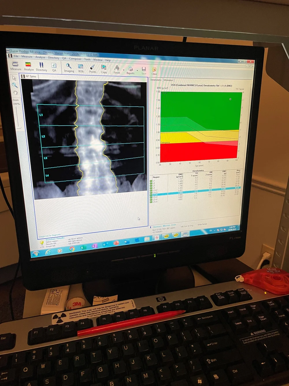 Kingston Imaging Services (KIS): X-Ray & Ultrasound Services