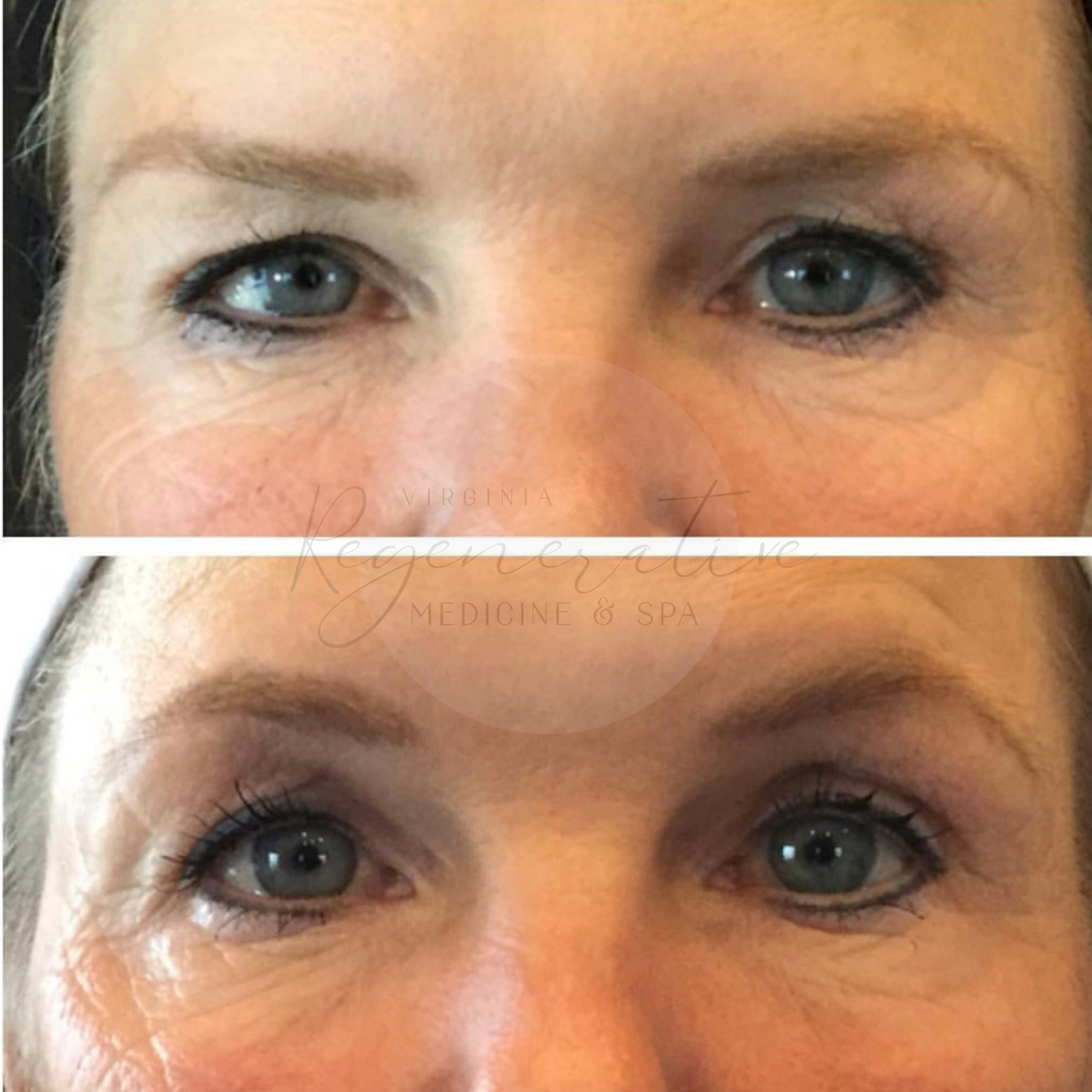 Gallery — Virginia Regenerative Medicine & Spa