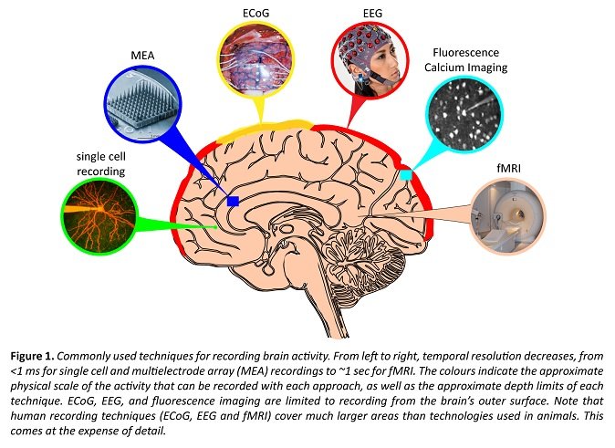 Neural Activity: The Basis of Brain Function — Stretchable ...