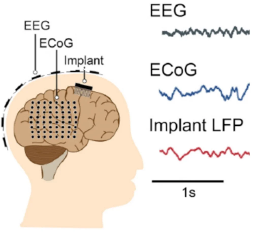 Discover BMSEED’s ECoG with stretchable MEA technology. enhanced ...