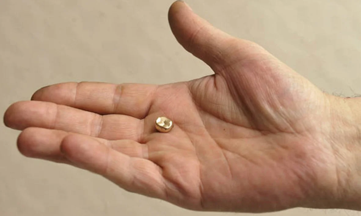 Dental Bridges - Replace Teeth | Paramount Dental Sydney — Paramount ...