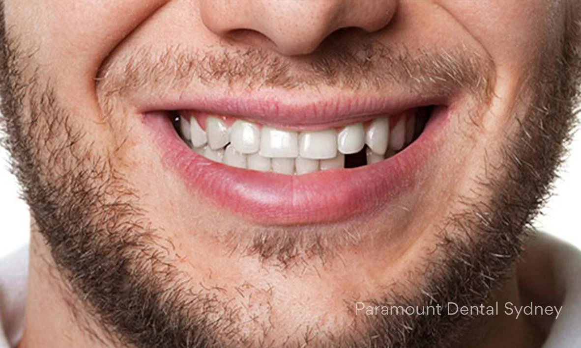 Cosmetic Dentistry - Perfect Your Smile | Paramount Dental Sydney — Paramount Dental Sydney