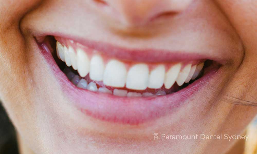Best Dentist Sydney CBD | Paramount Dental