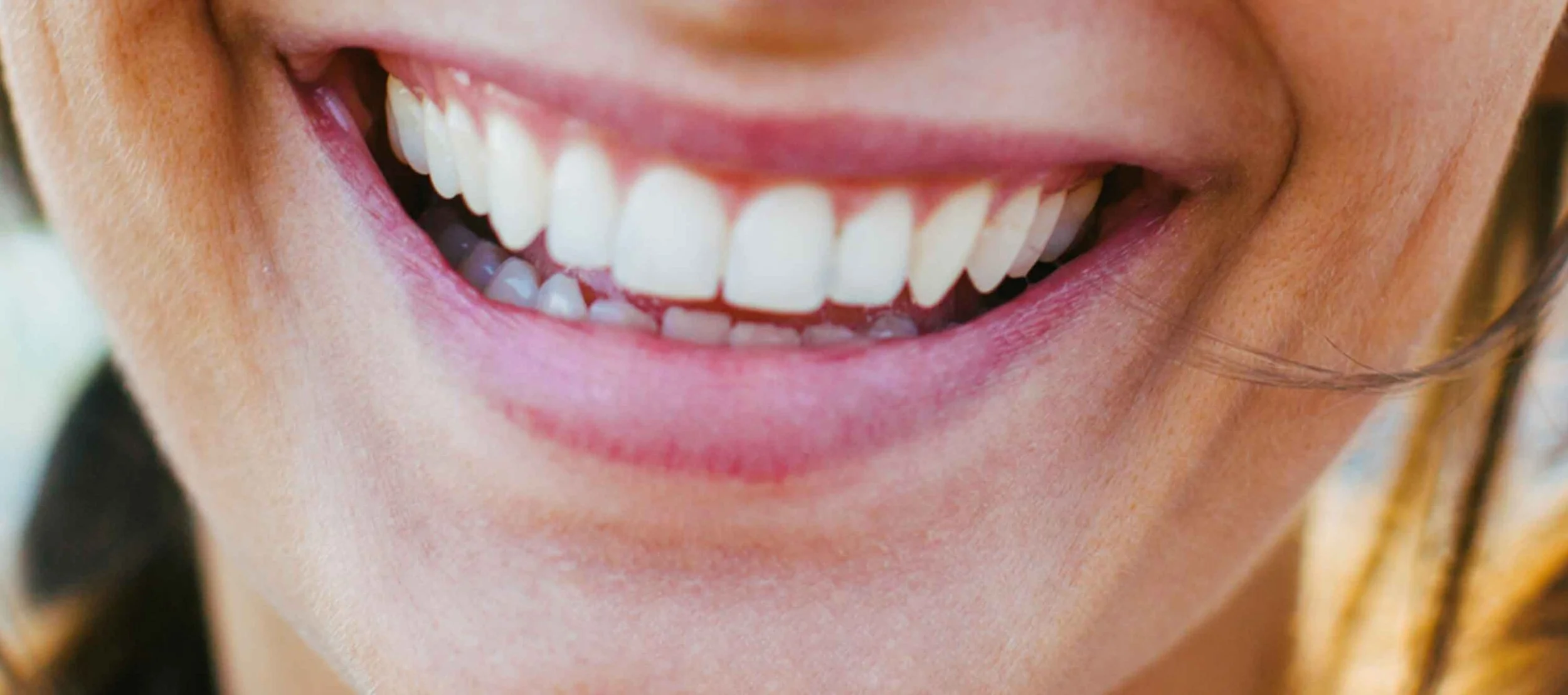 Best Dentist Sydney CBD | Paramount Dental