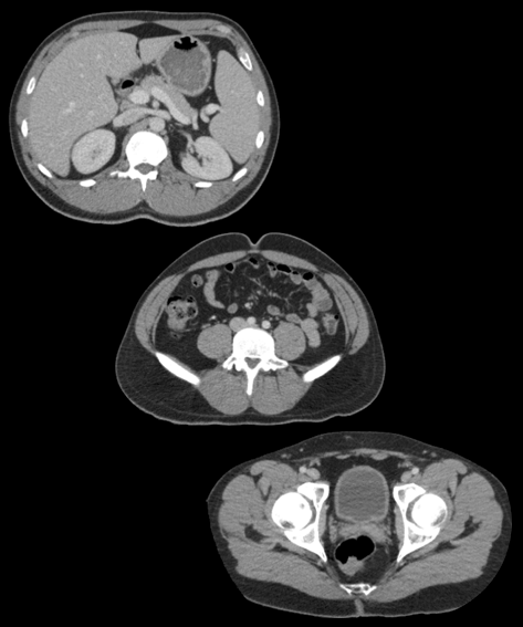 Abdomen view — Radiology Nation