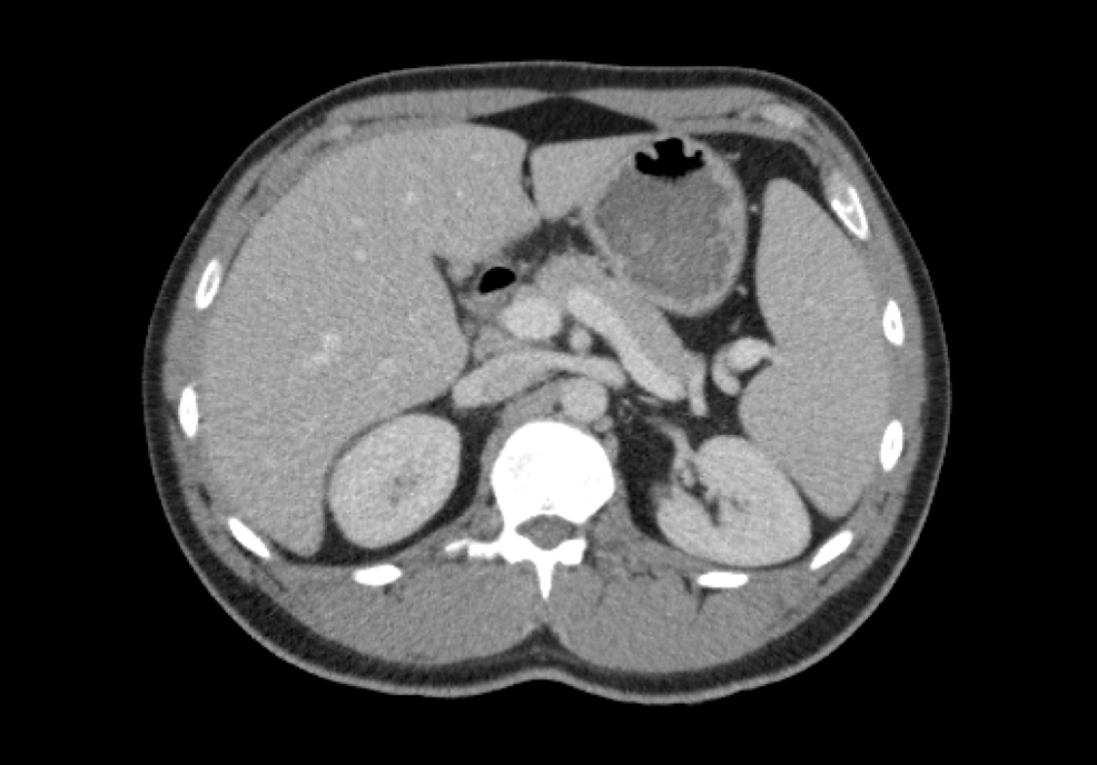 GUIDE TO BODY IMAGING — Radiology Nation