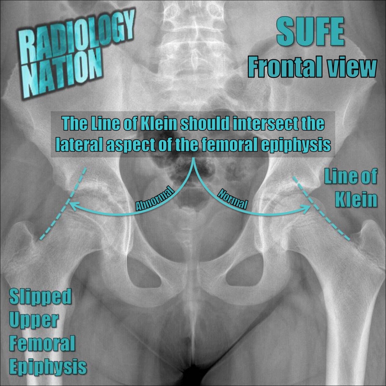 Musculoskeletal Radiographs — Radiology Nation
