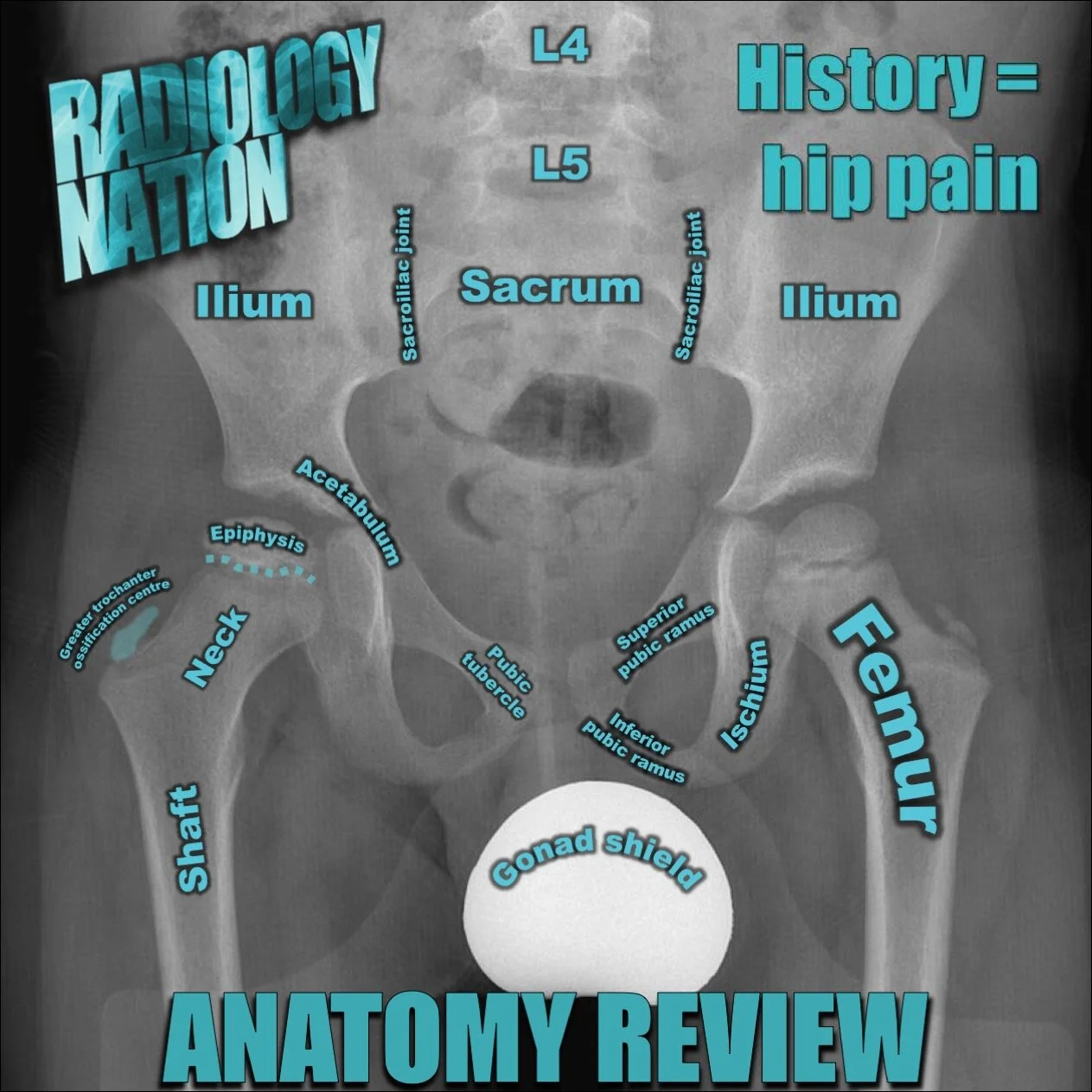 Musculoskeletal Radiographs — Radiology Nation