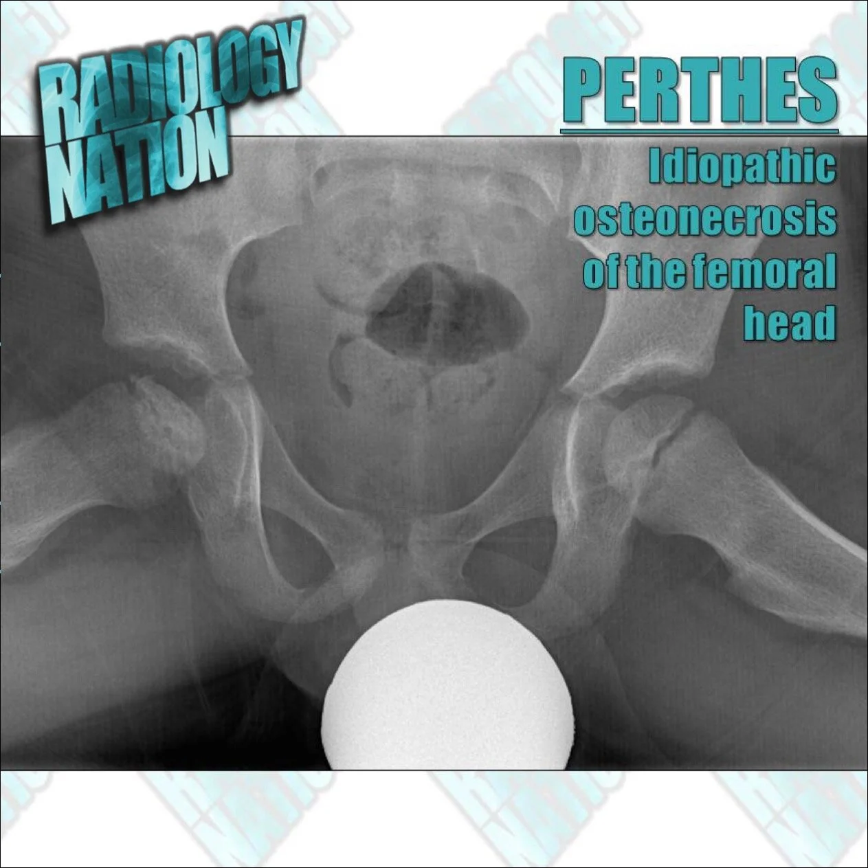 Musculoskeletal Radiographs — Radiology Nation