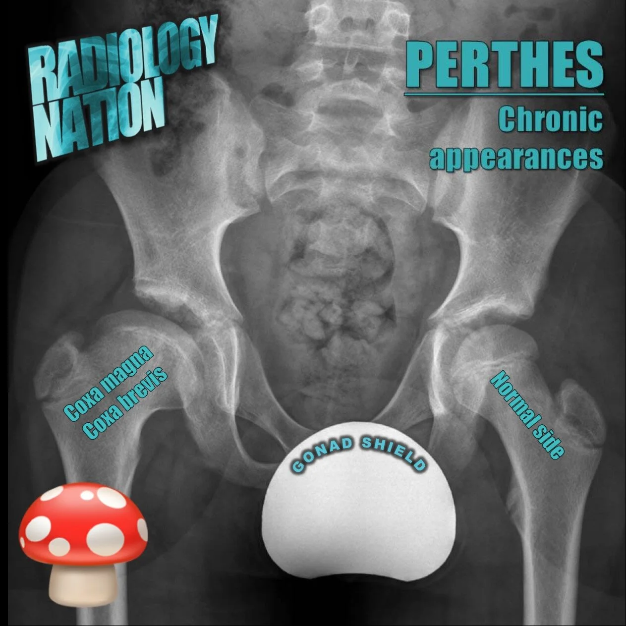 Musculoskeletal Radiographs — Radiology Nation