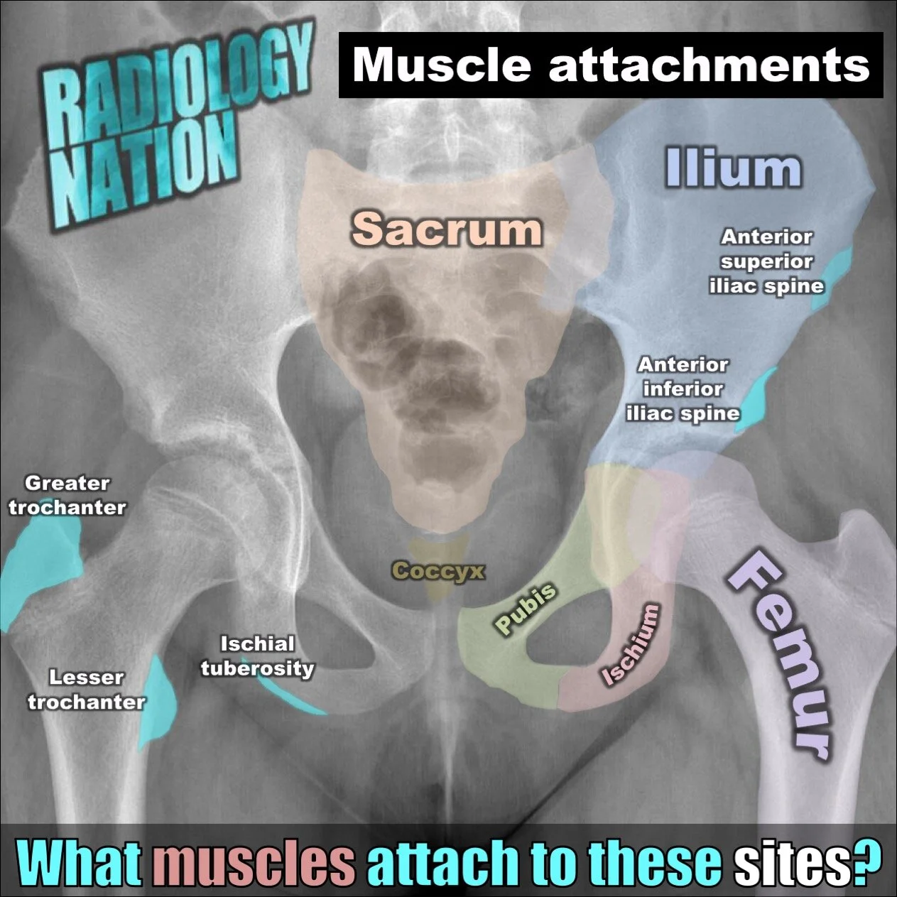 Musculoskeletal Radiographs — Radiology Nation