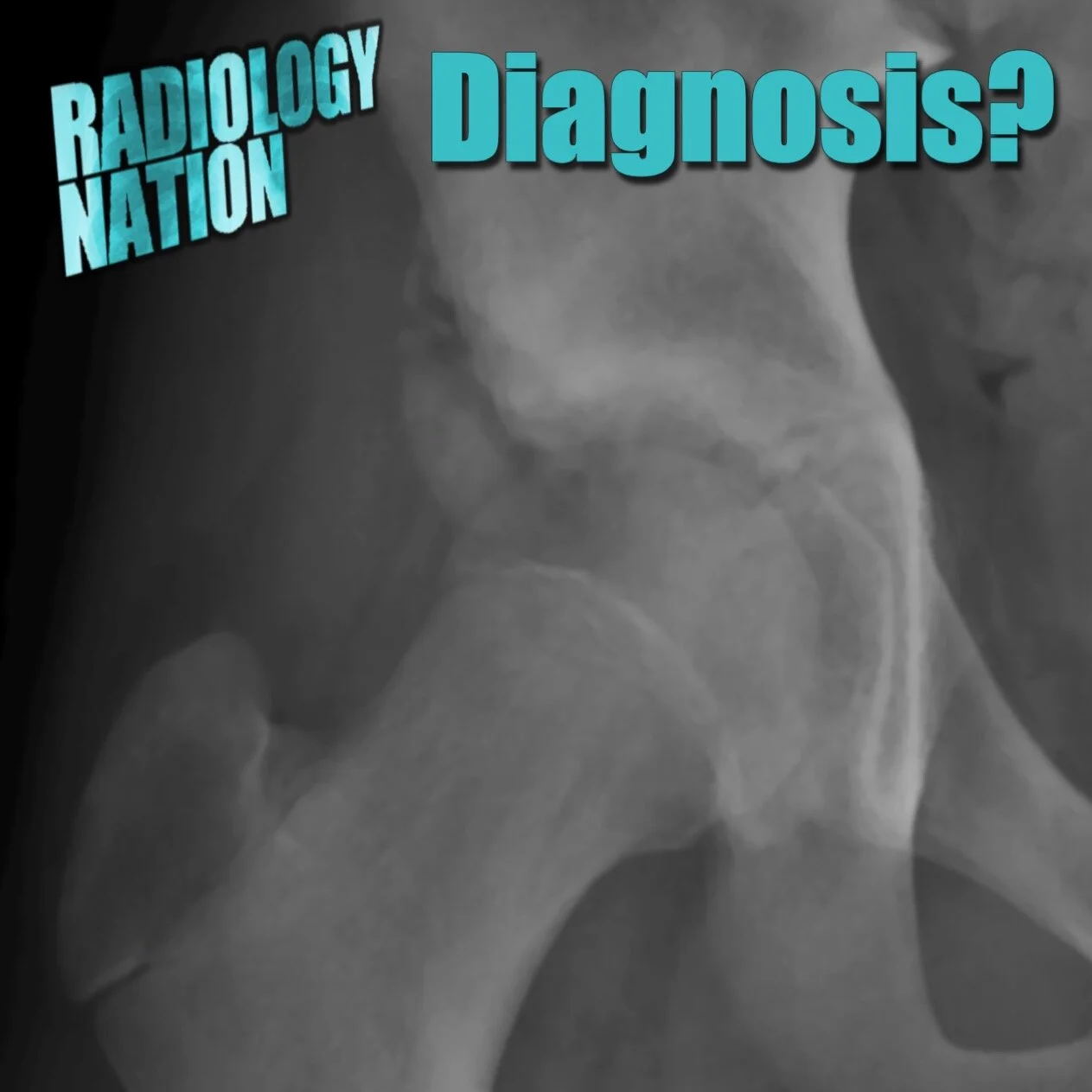 Musculoskeletal Radiographs — Radiology Nation
