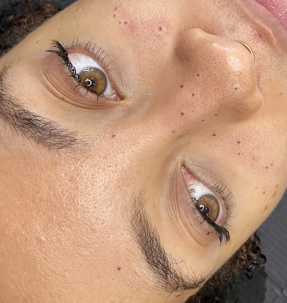 Freckles | Freckle Tattoos | Sage Cosmetic Tattoo