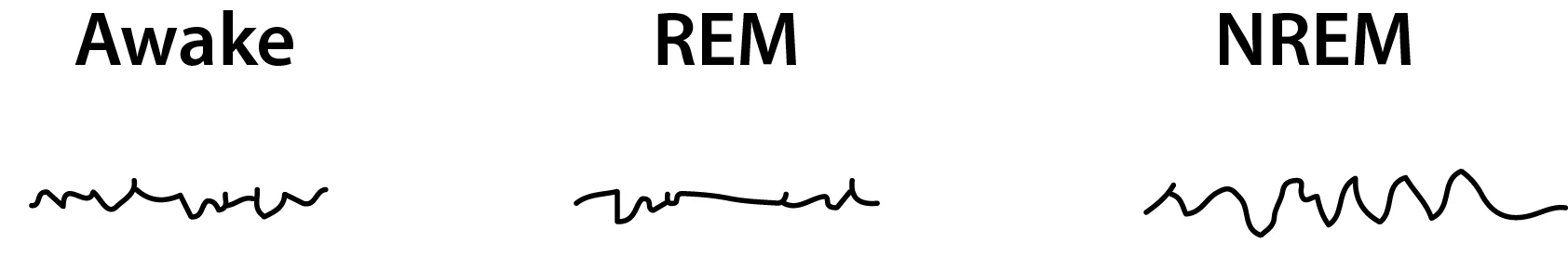 The Wave - The characteristics of an EEG — Firstclass