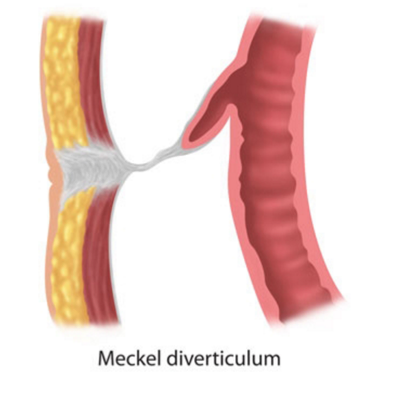 Gut Rotation - The Twist of Fate — Firstclass