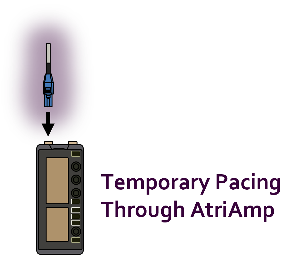 Atrility Medical - Improving access to the atrial electrogram