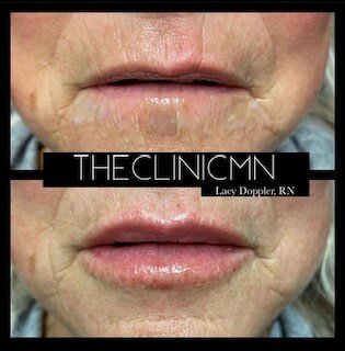 BEFORE & AFTER PHOTOS — The Clinic for Medical Aesthetics