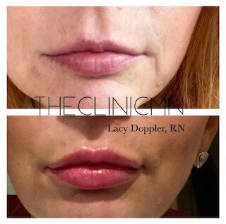 BEFORE & AFTER PHOTOS — The Clinic for Medical Aesthetics