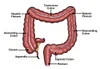 Colon anatomy and colonoscopy — Medilex: The Experts on Medical Experts